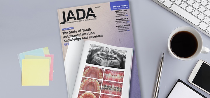 JADA | American Dental Association