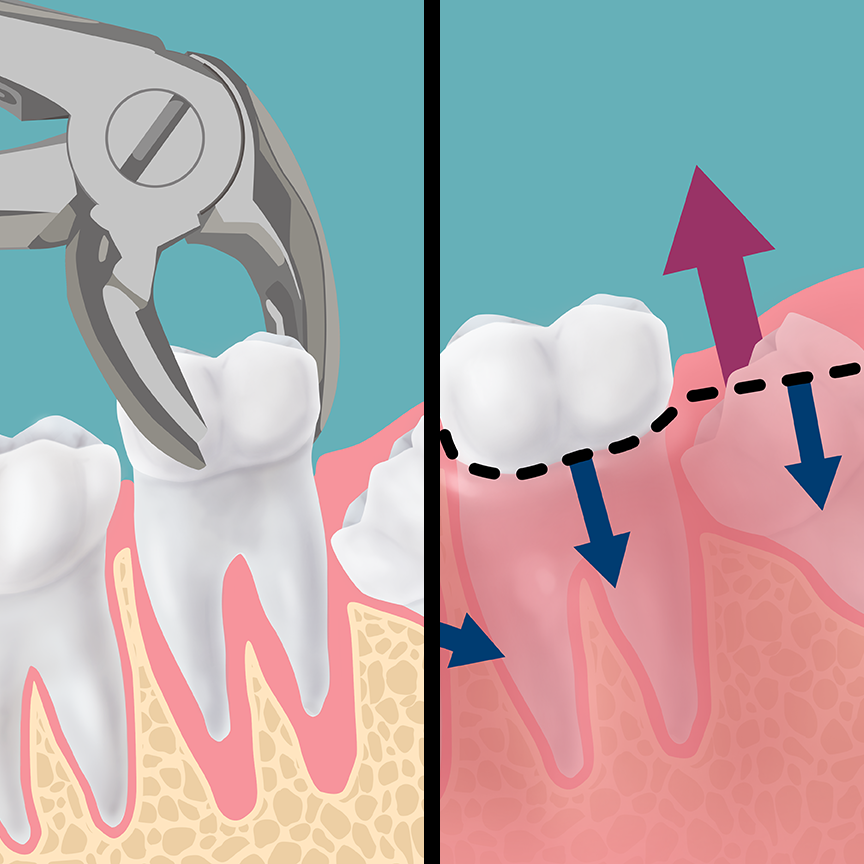 These recommendations apply to